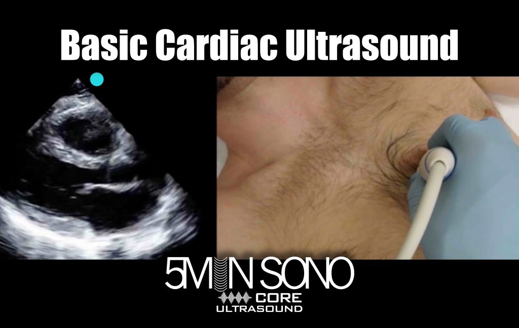 Basic Cardiac Function – Core Ultrasound