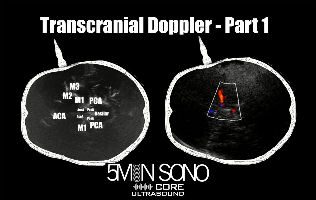 5 Minute Sono – Transcranial Doppler Part 1 – Core Ultrasound