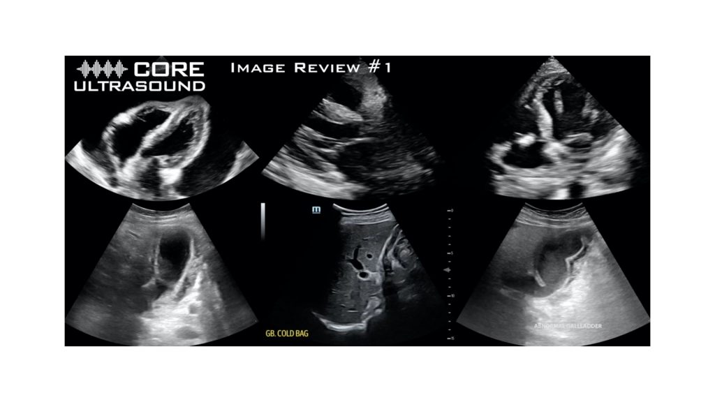 Core Ultrasound Image Review #1 – Core Ultrasound