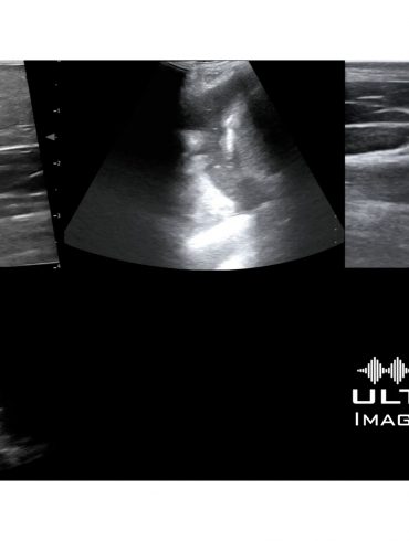 Image Review – Core Ultrasound