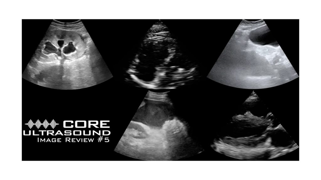 Core Ultrasound Image Review, Episode 5 – Core Ultrasound