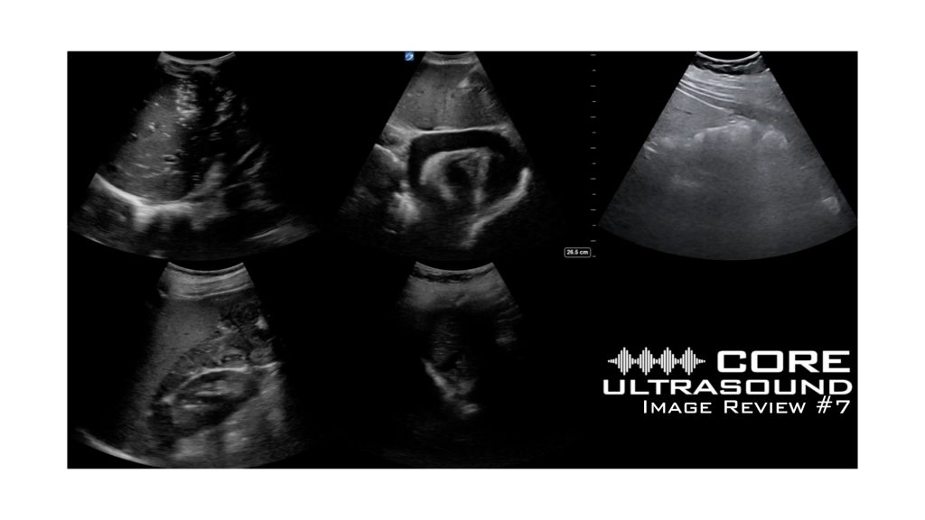 Core Ultrasound Image Review, Episode 7! – Core Ultrasound