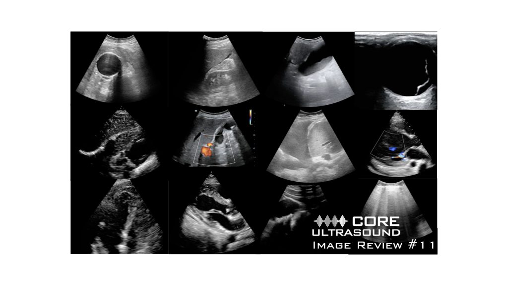 Core Ultrasound Image Review, Episode 11! – Core Ultrasound