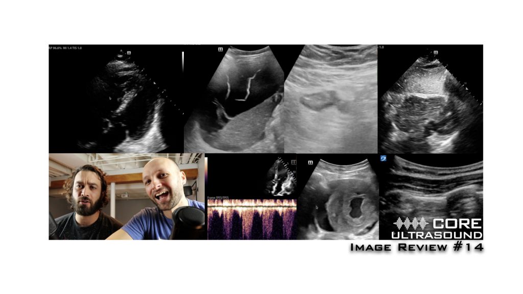 Core Ultrasound Image Review, Episode 14! – Core Ultrasound