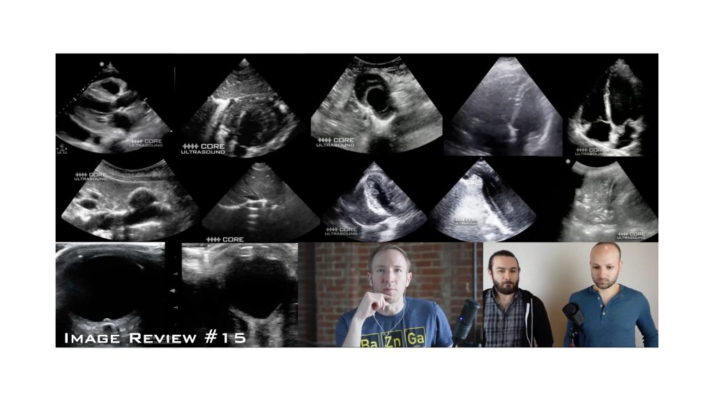 Core Ultrasound Image Review, Episode 15 – Core Ultrasound