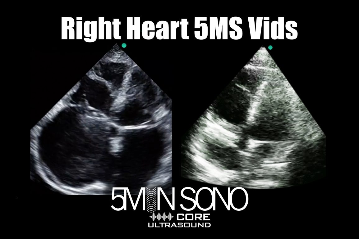 5 Minute Sono – Core Ultrasound
