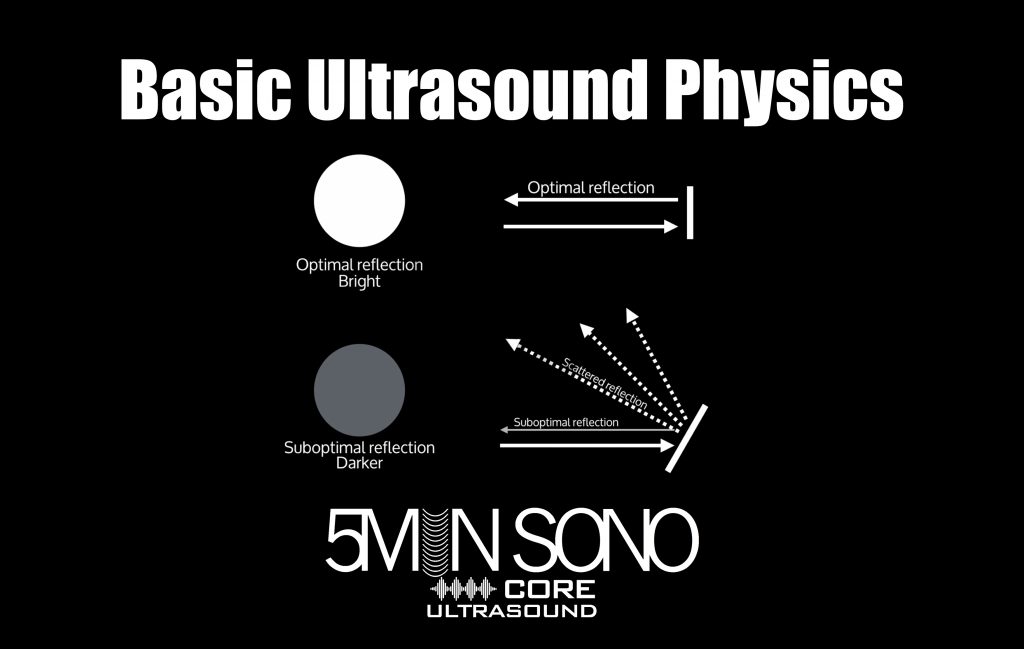 5 Min Sono – Basic Ultrasound Physics – Core Ultrasound
