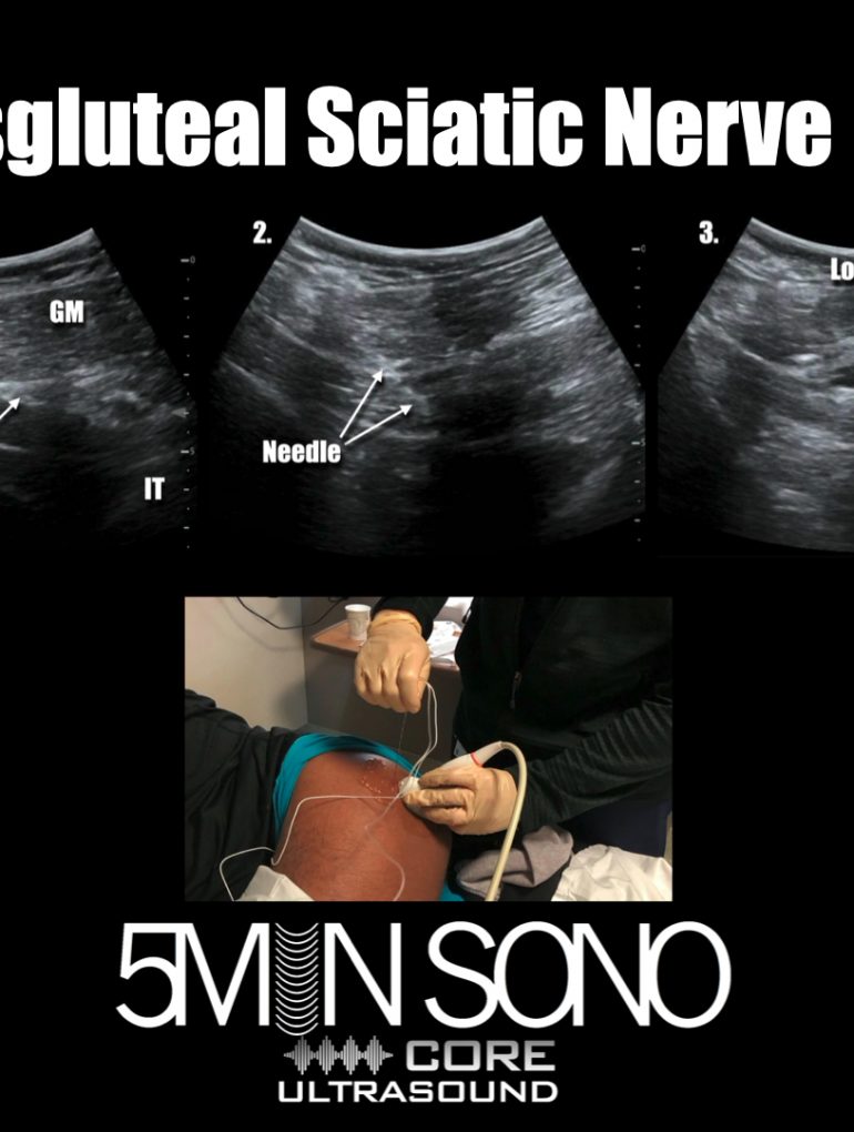 5 Minute Sono – Core Ultrasound