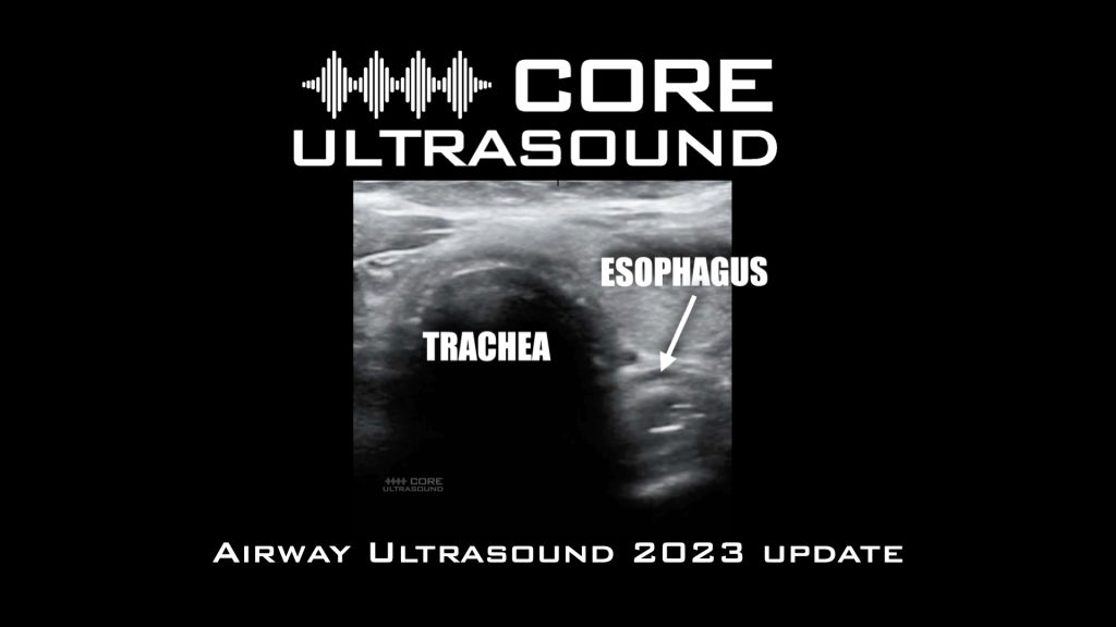 Airway Ultrasound 2023 update – Core Ultrasound