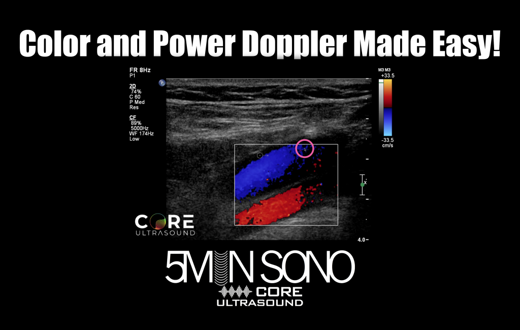 Power and Color Doppler Physics 5MS! – Core Ultrasound